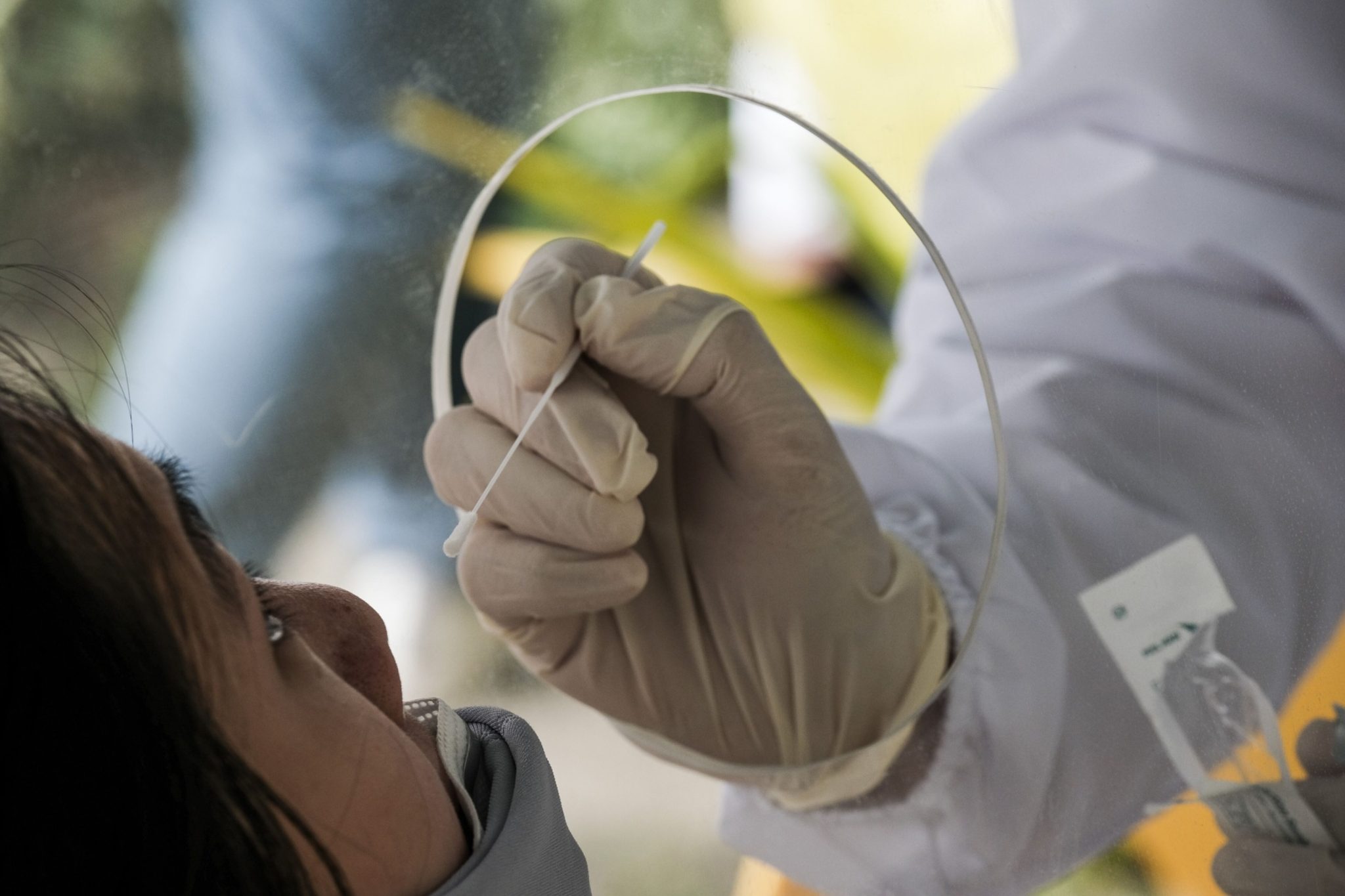 Covid led to persistent cognitive deficits in small UK study - Moneyweb